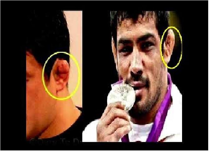 पहलवानों के कान की हड्डी टूटी हुई क्यों होती है? जाइए क्या है इसके पीछे ...