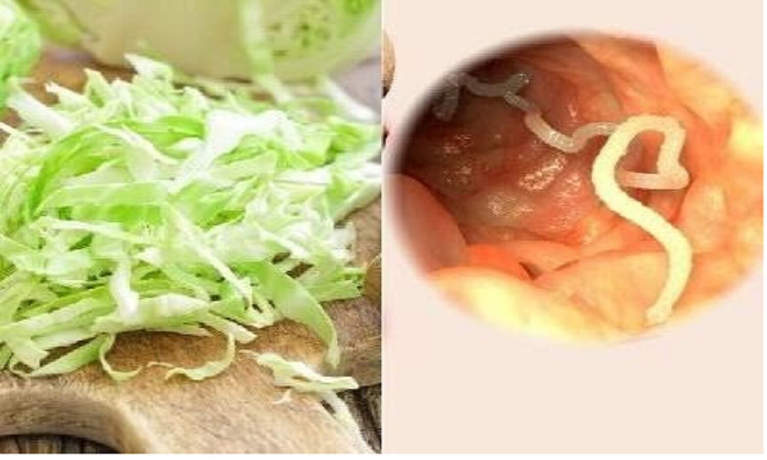 Patta Gobhi Me Kida: पत्ता गोभी में मिलने वाले इस कीड़े के बारे में ...