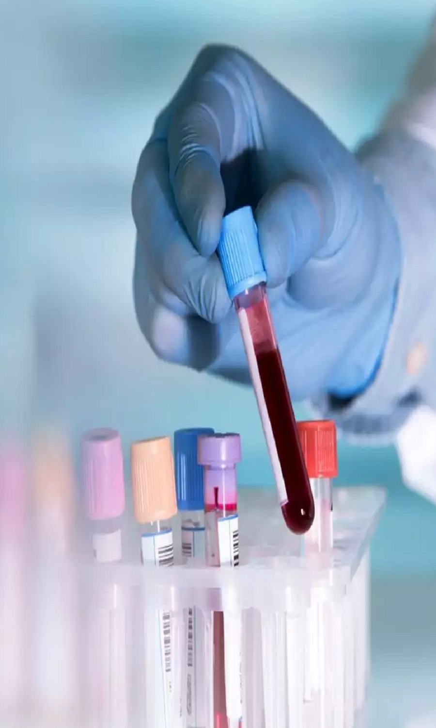 पहली बार लैब में बना खून इंसानों को चढ़ाया, इससे लोगों की मदद होगी